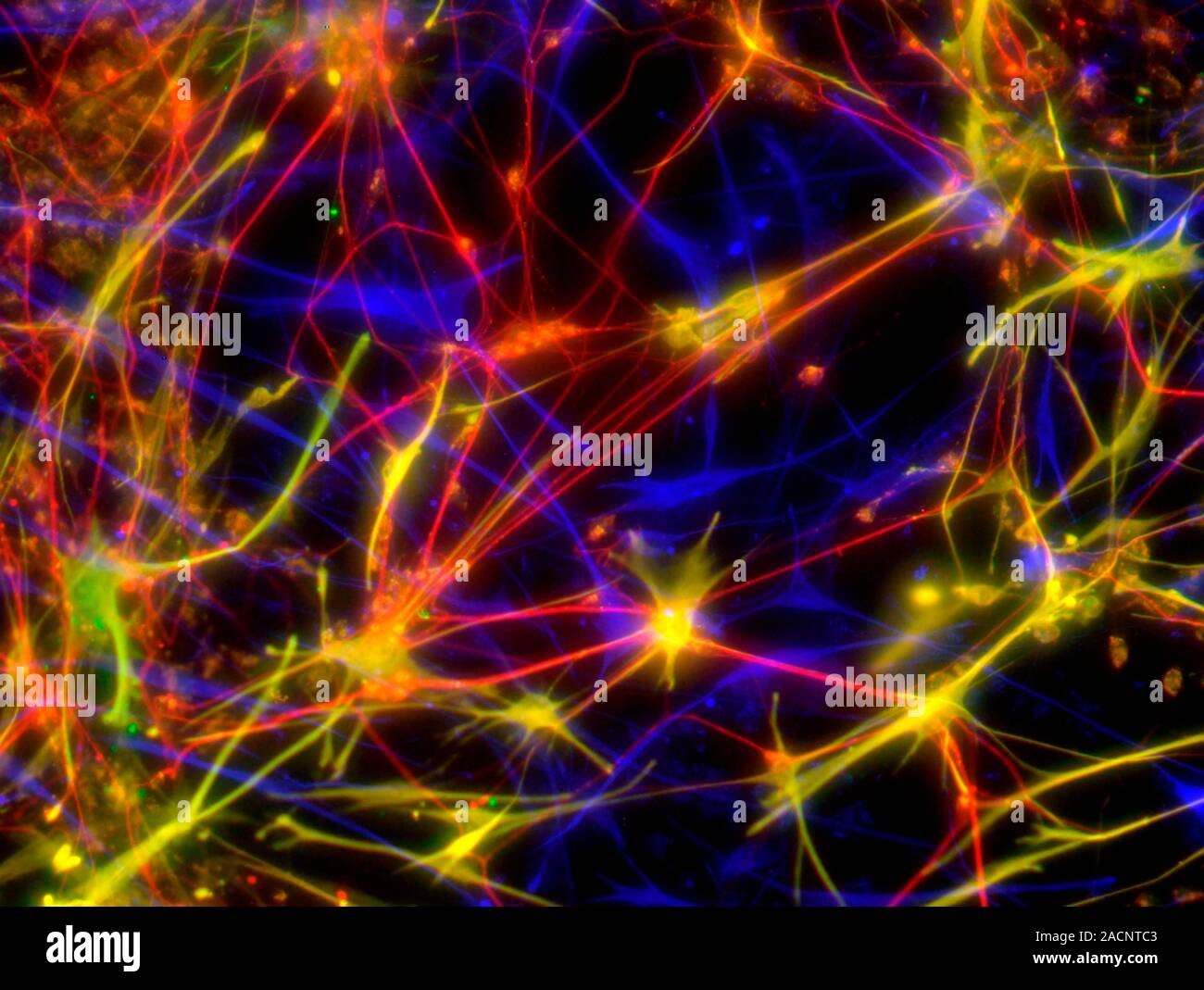 Stem cell-derived nerve cells. Fluorescence light micrograph of neural ...