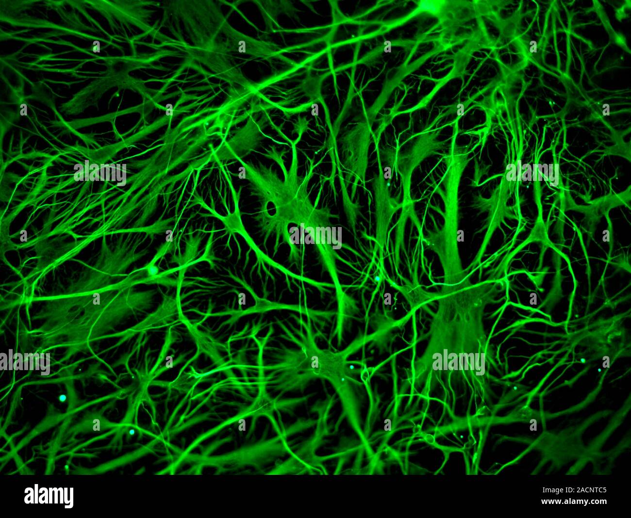 Astrocyte brain cells. Fluorescence light micrograph of primary ...
