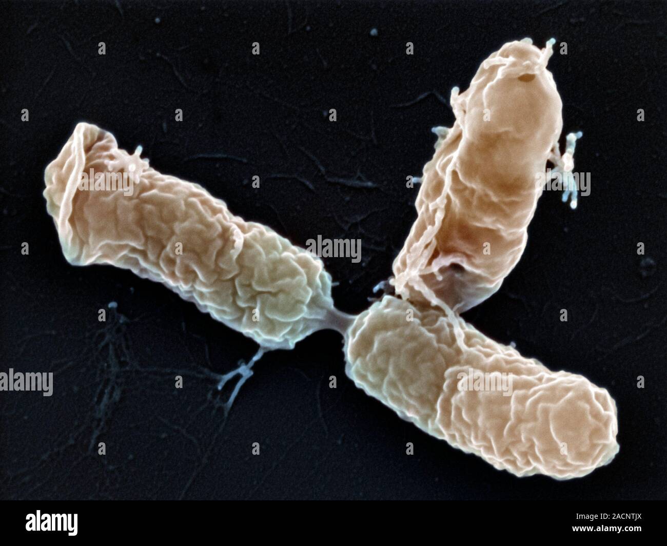 Bordetella pertussis bacteria. Coloured scanning electron micrograph ... Bordetella pertussis bacteria. Coloured scanning electron micrograph ...