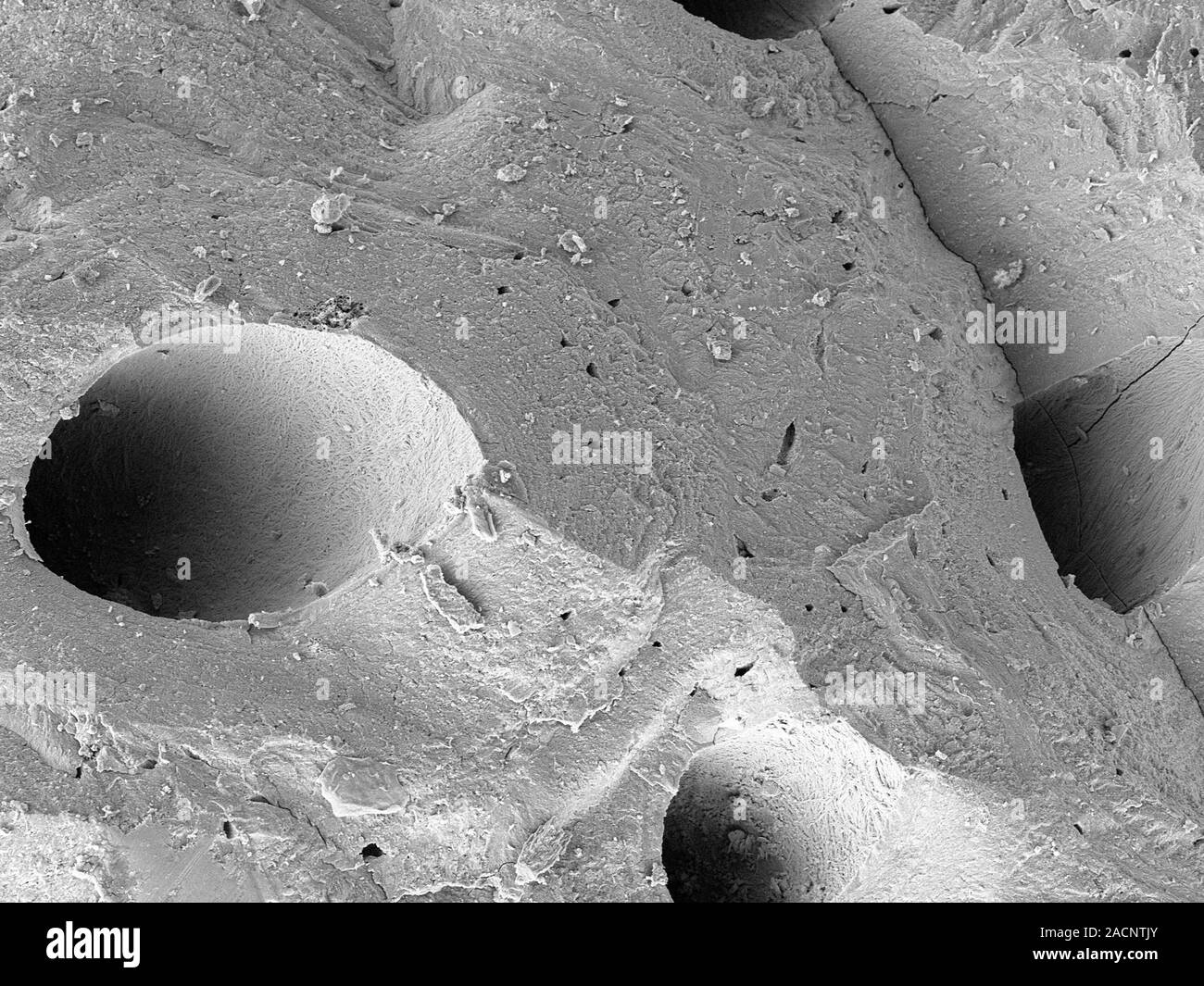 Dinosaur bone. Scanning electron micrograph (SEM) of cancellous (spongy ...