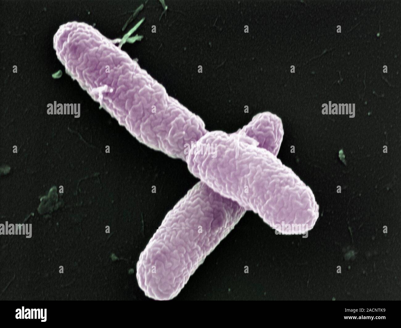 Burkholderia cepacia bacteria. Coloured scanning electron micrograph ...