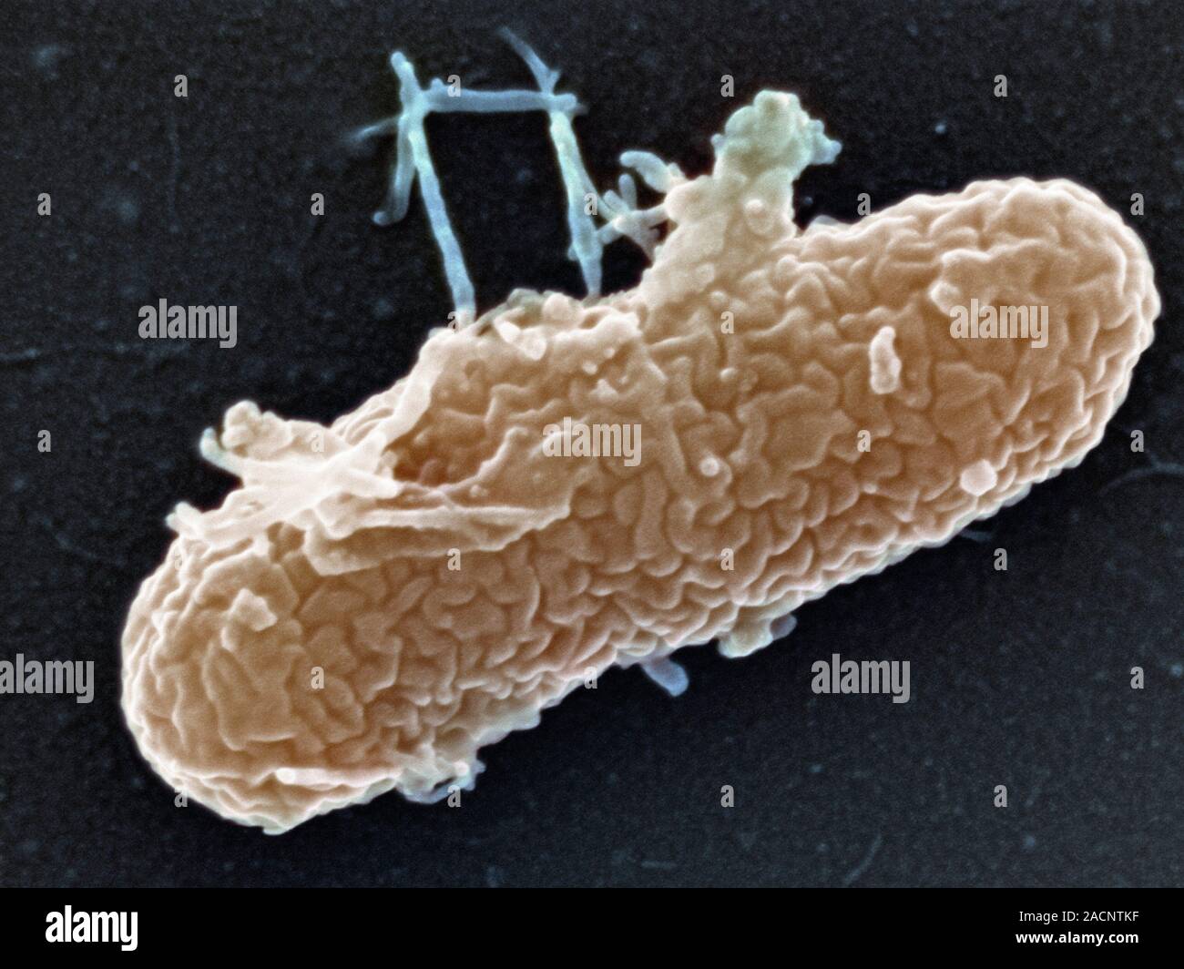 Burkholderia cepacia bacterium. Coloured scanning electron micrograph ...