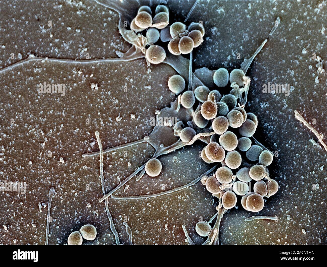Staphylococcus aureus bacteria. Coloured scanning electron micrograph ...
