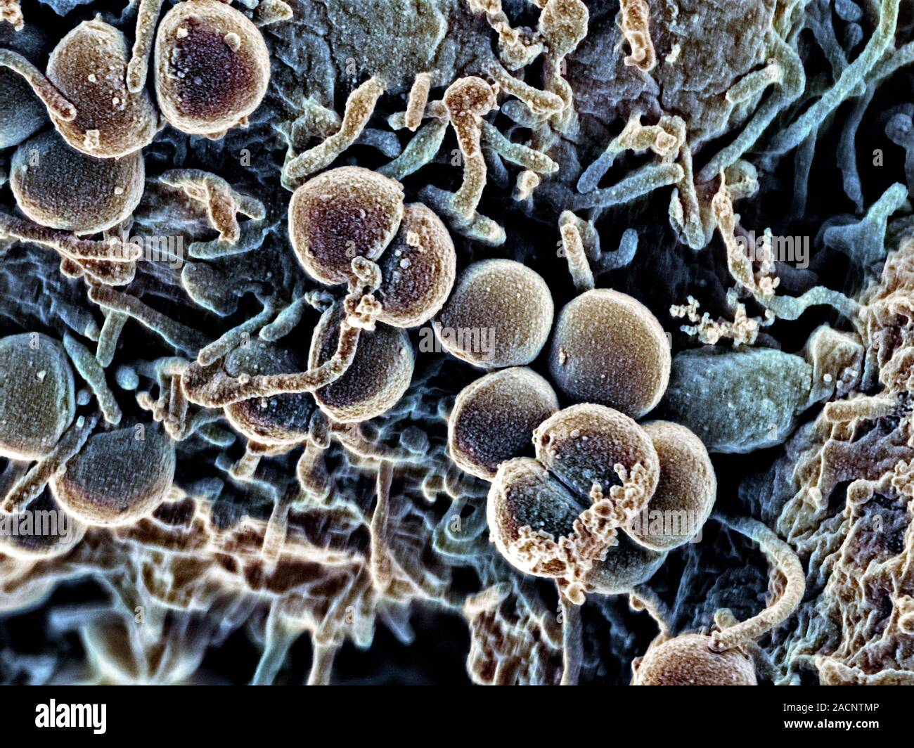 Staphylococcus aureus bacteria. Coloured scanning electron micrograph ... Staphylococcus aureus bacteria. Coloured scanning electron micrograph ...