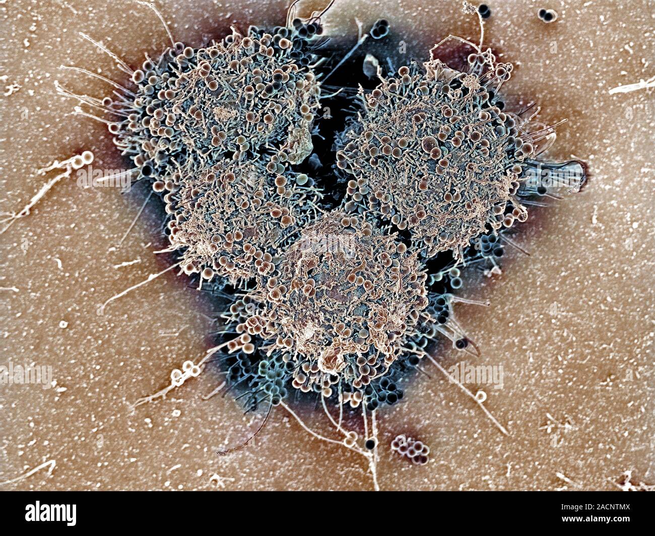 Staphylococcus aureus bacteria. Coloured scanning electron micrograph ...