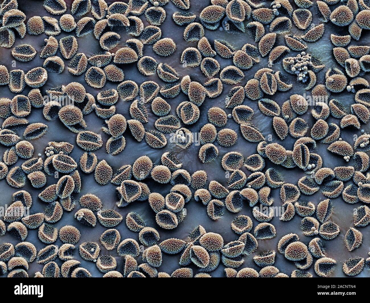 Fungal spores. Coloured scanning electron micrograph (SEM) of numerous ...