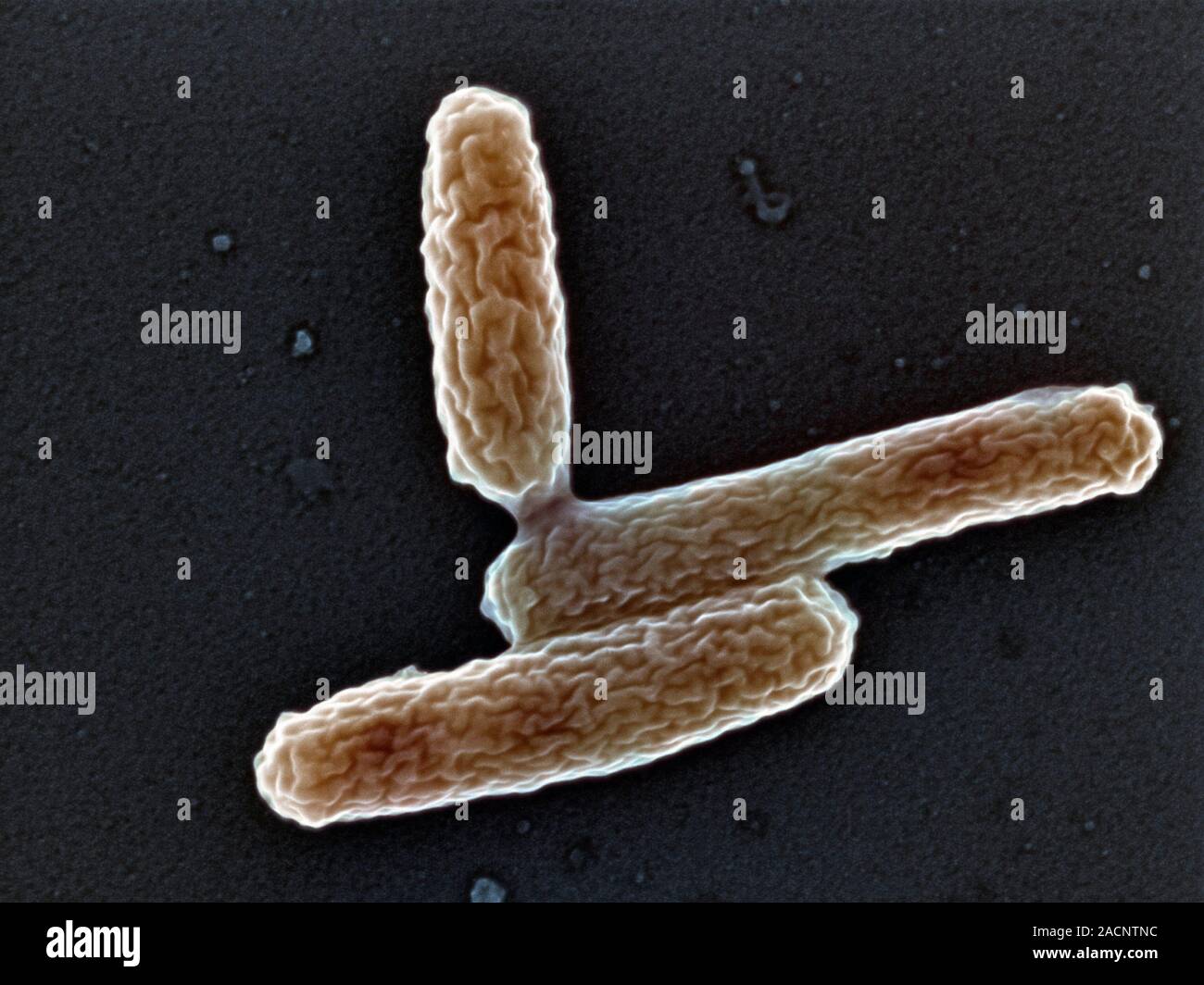 Legionella bacteria. Coloured scanning electron micrograph (SEM) of ...