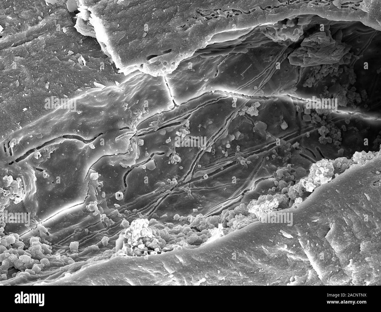 Dinosaur bone. Scanning electron micrograph (SEM) of cancellous (spongy ...