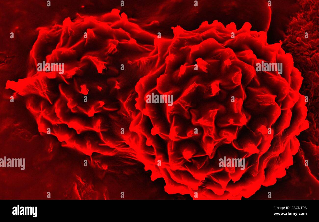 Fungal spores. Coloured scanning electron micrograph (SEM) of spores ...