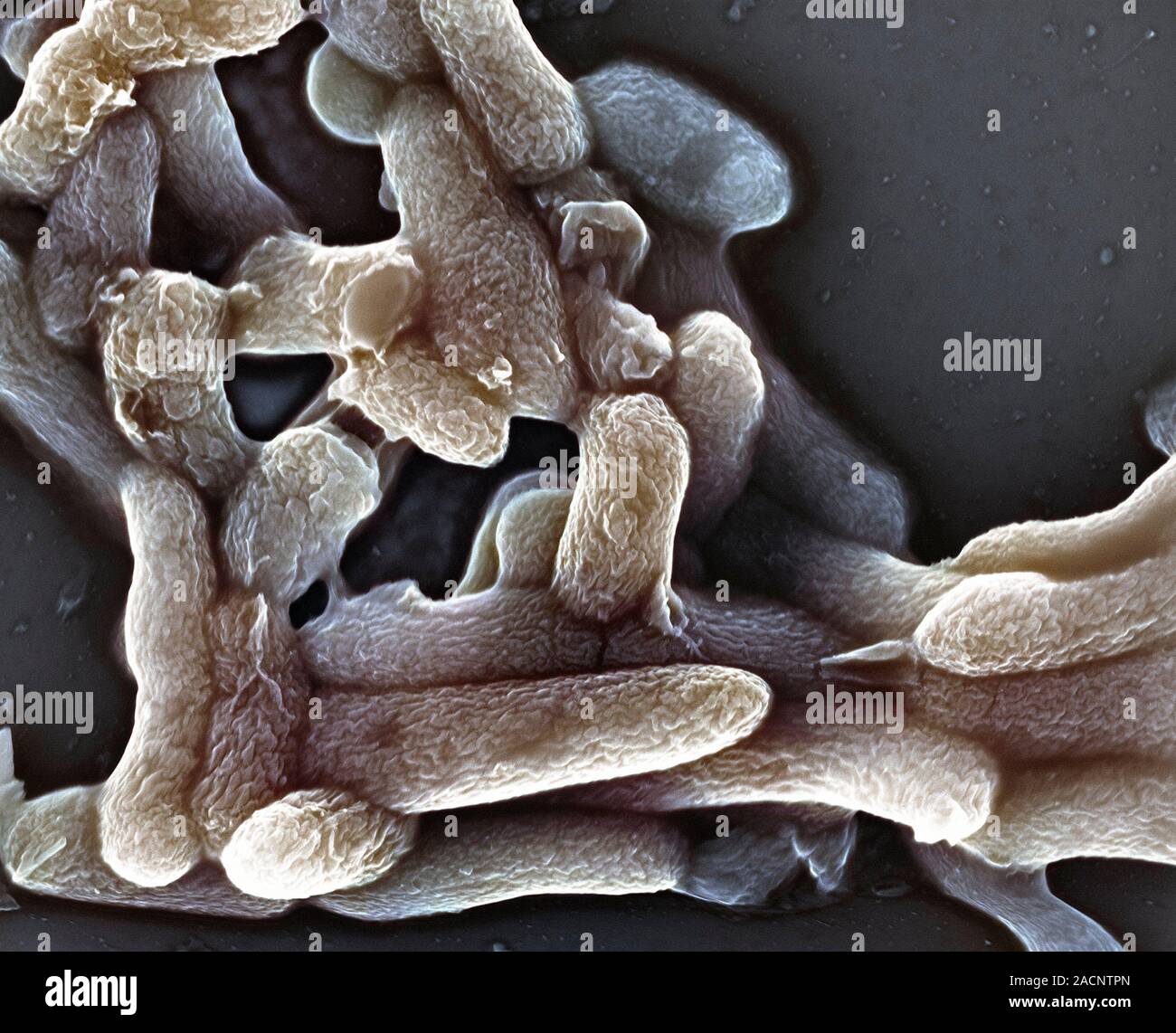 Salmonella bacteria. Coloured scanning electron micrograph (SEM) of ...