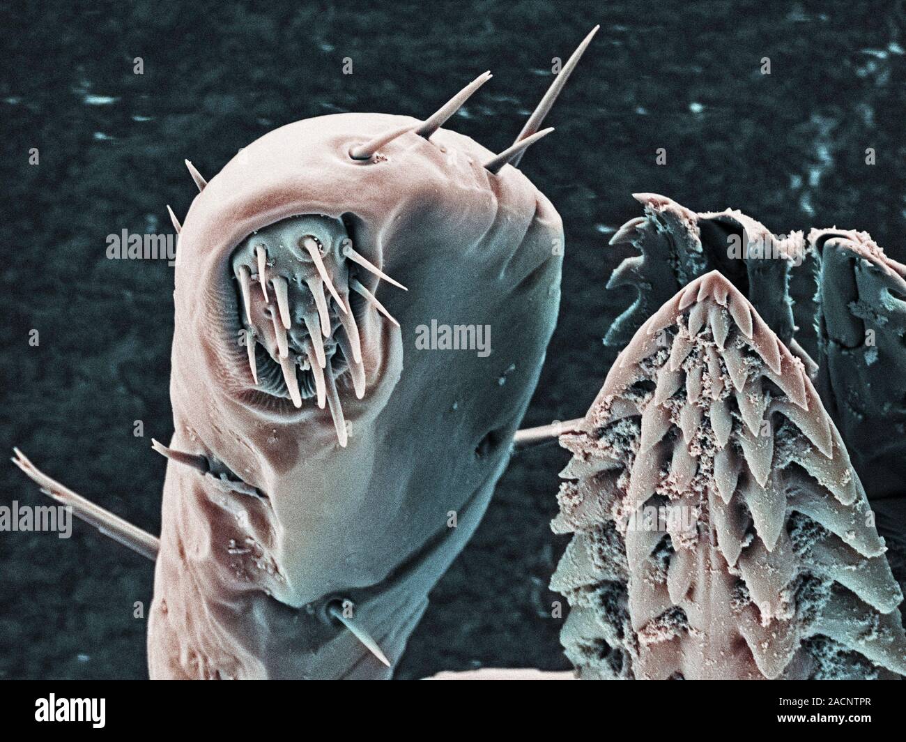 Tick mouthparts. Coloured scanning electron micrograph (SEM) of the ...