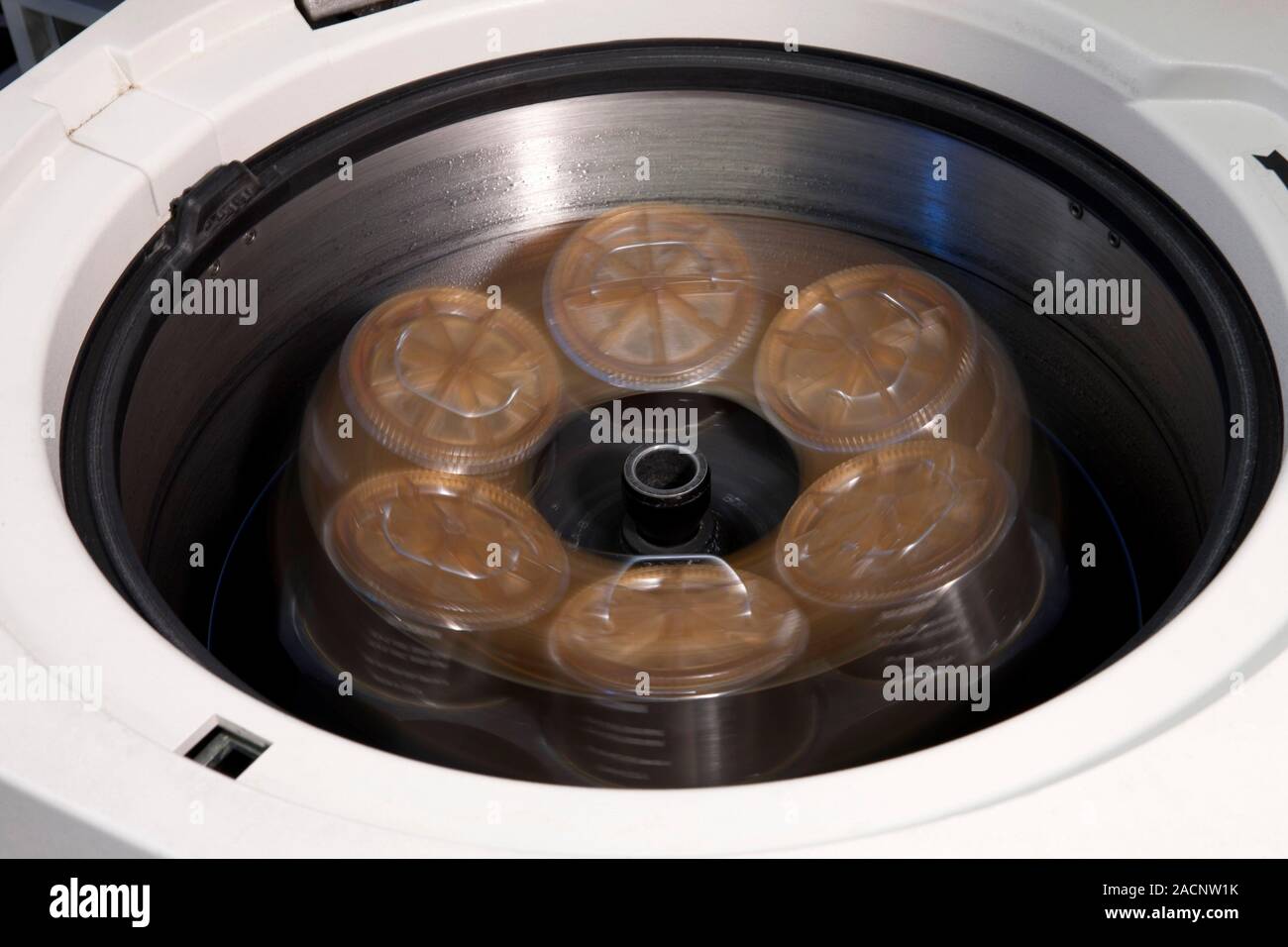 Chikungunya virus research. Centrifuge being used to separate ...
