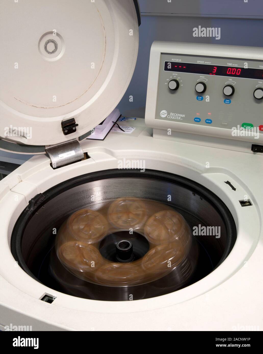 Chikungunya virus research. Centrifuge being used to separate ...
