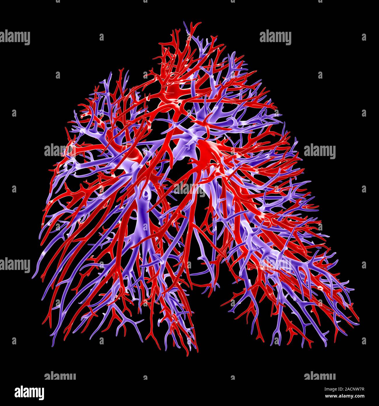 Lung blood vessels, computer artwork. Shown are the lung blood vessels ...