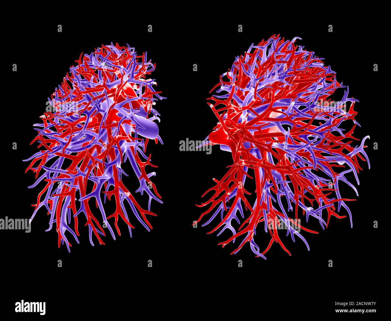 Lung blood vessels, computer artwork. Shown are the lung blood vessels ...