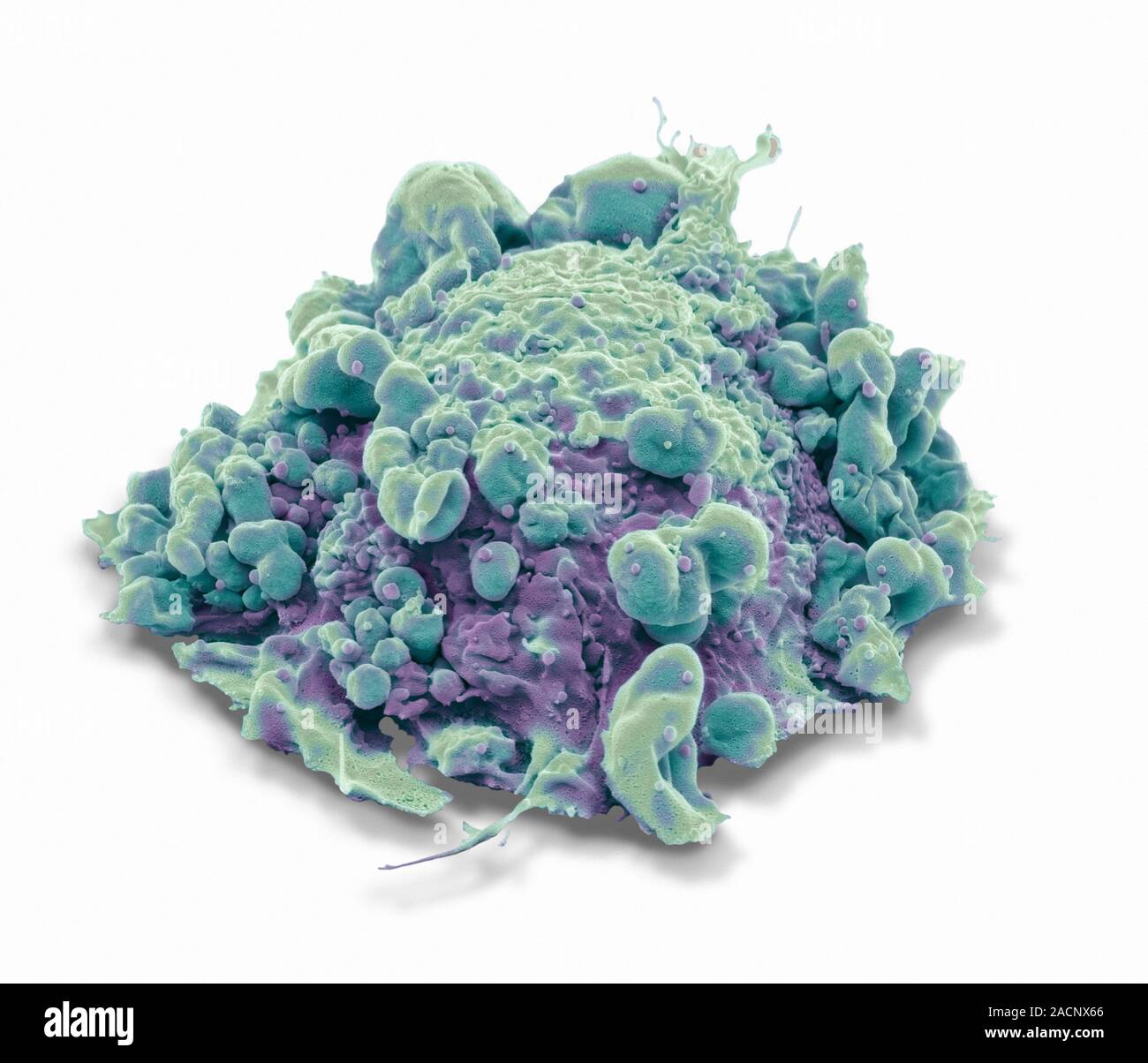 Colorectal Cancer Cell Coloured Scanning Electron Micrograph Sem Of