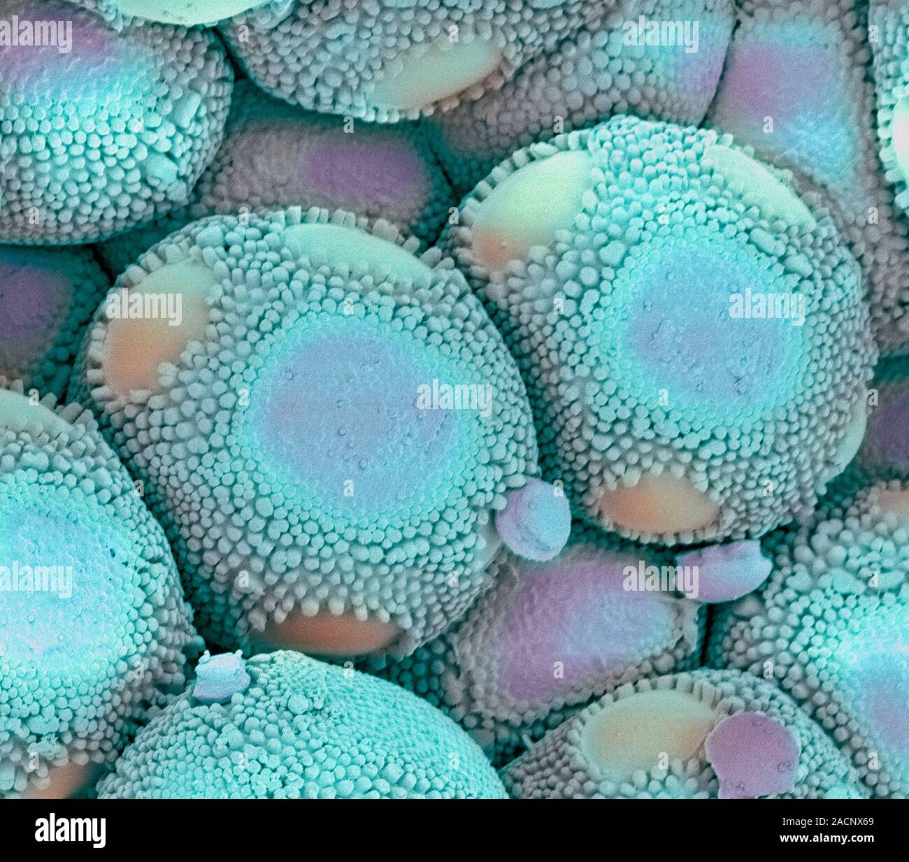 Rust fungus infection. Coloured scanning electron micrograph (SEM) of ...