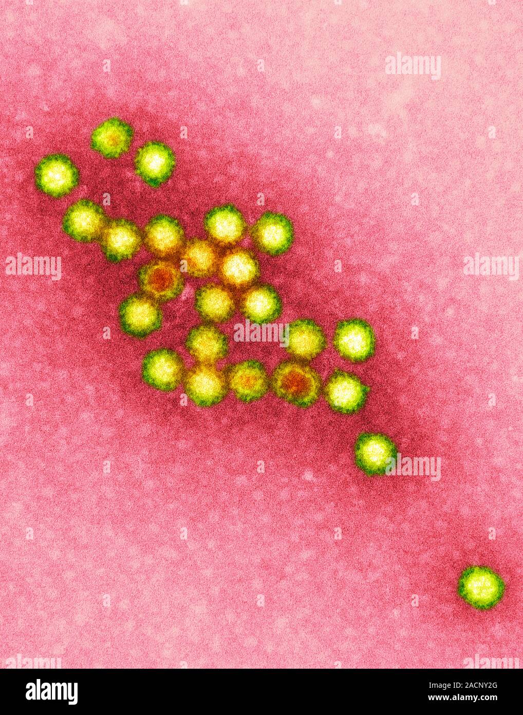 Norovirus particles. Coloured transmission electron micrograph (TEM) of ...