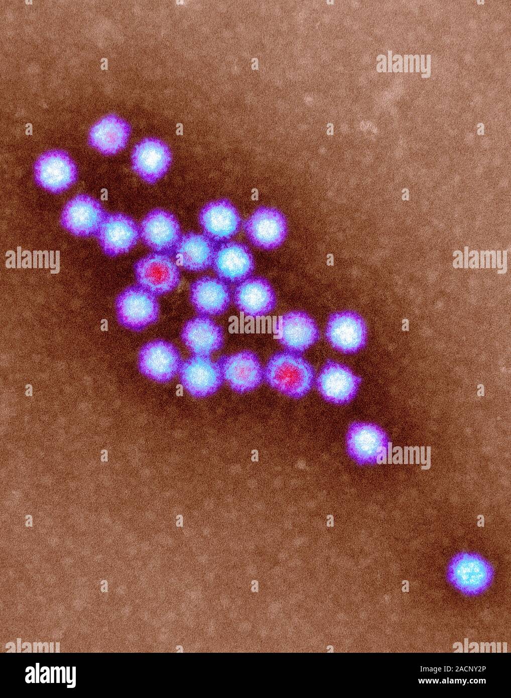 Norovirus particles. Coloured transmission electron micrograph (TEM) of norovirus particles ...