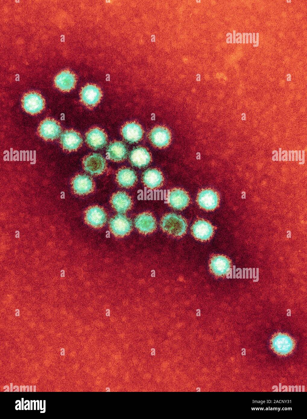 Norovirus particles. Coloured transmission electron micrograph (TEM) of ...