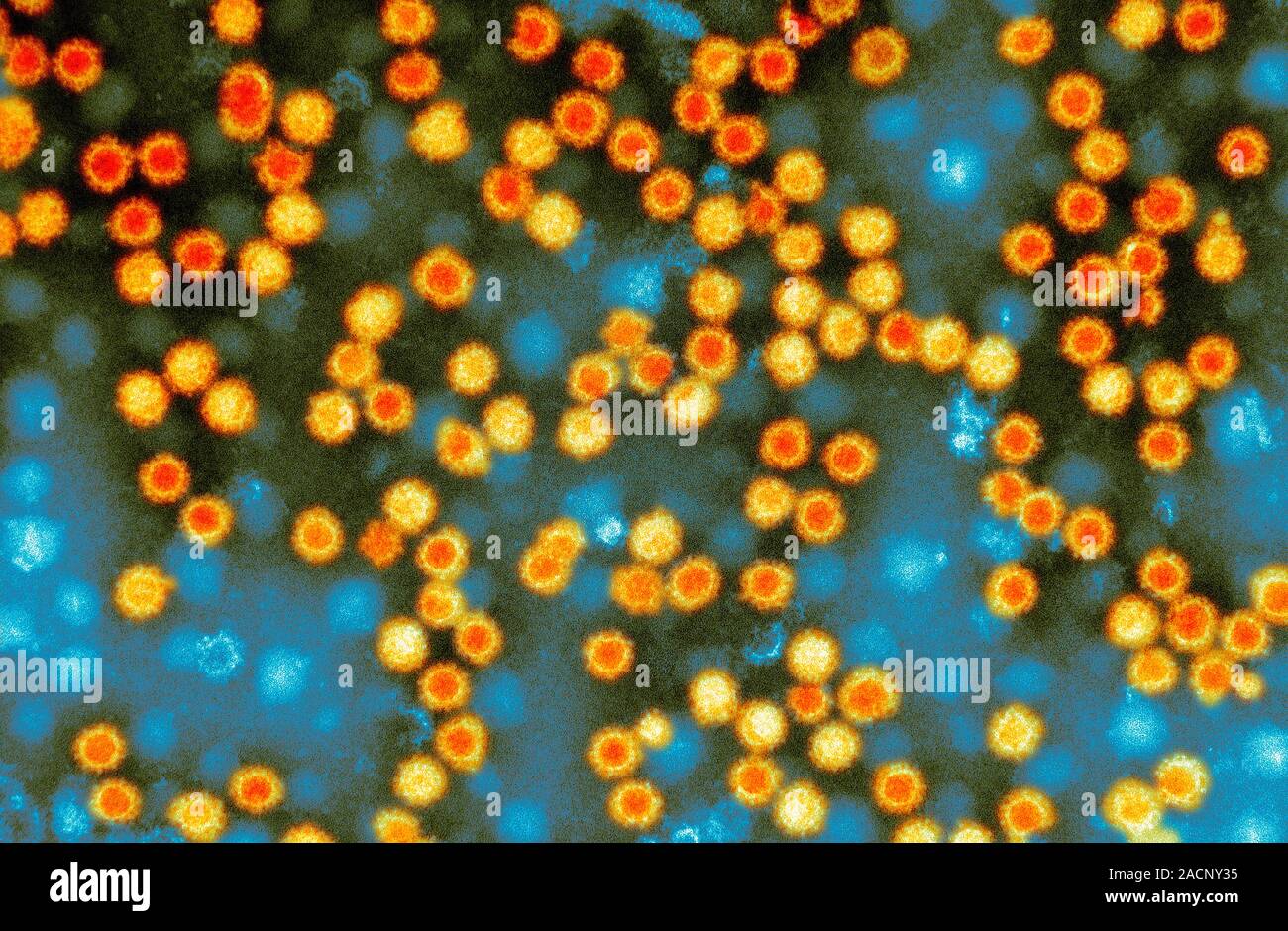 Norovirus particles. Coloured transmission electron micrograph (TEM) of ...