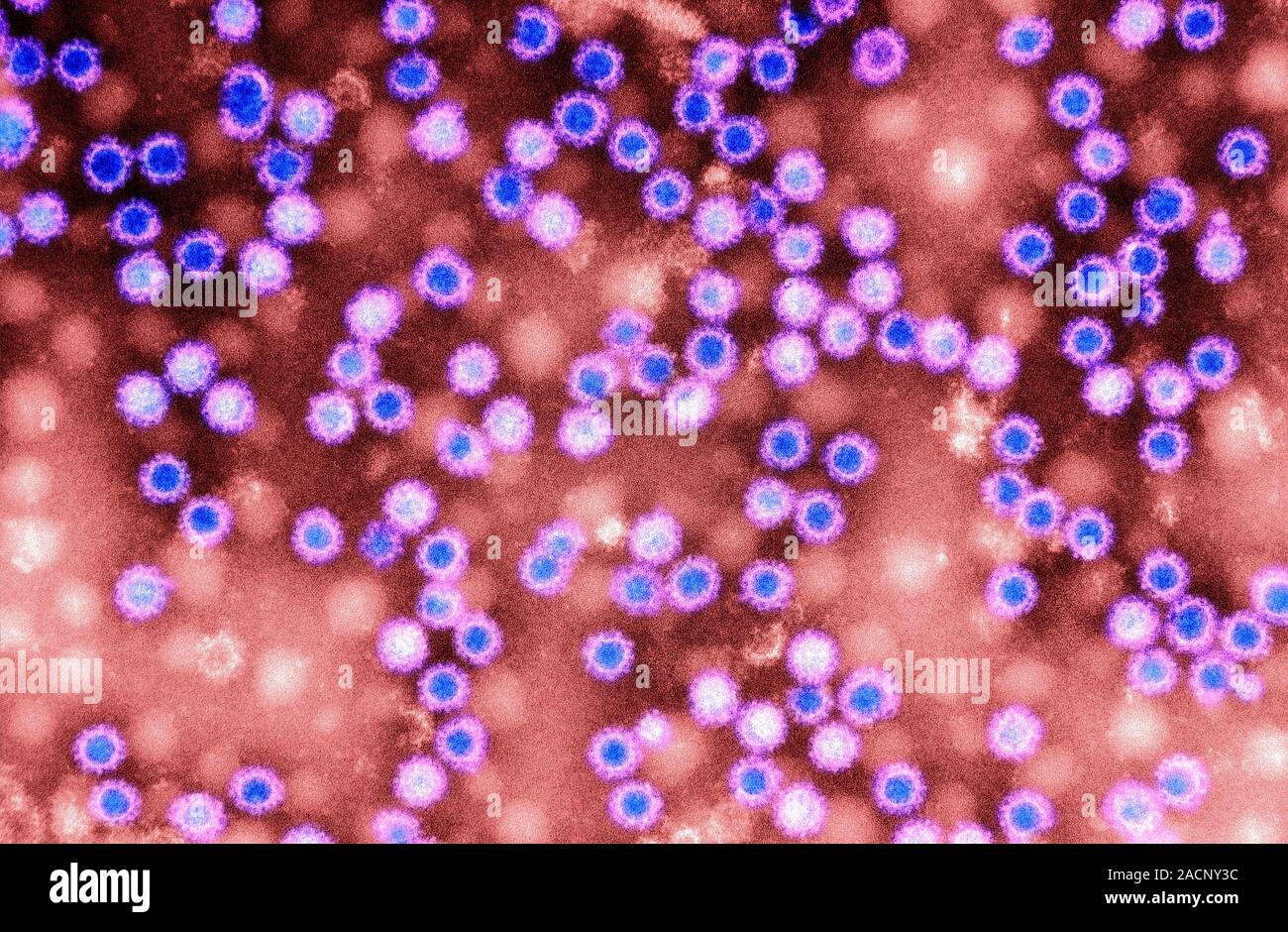 Norovirus particles. Coloured transmission electron micrograph (TEM) of ...