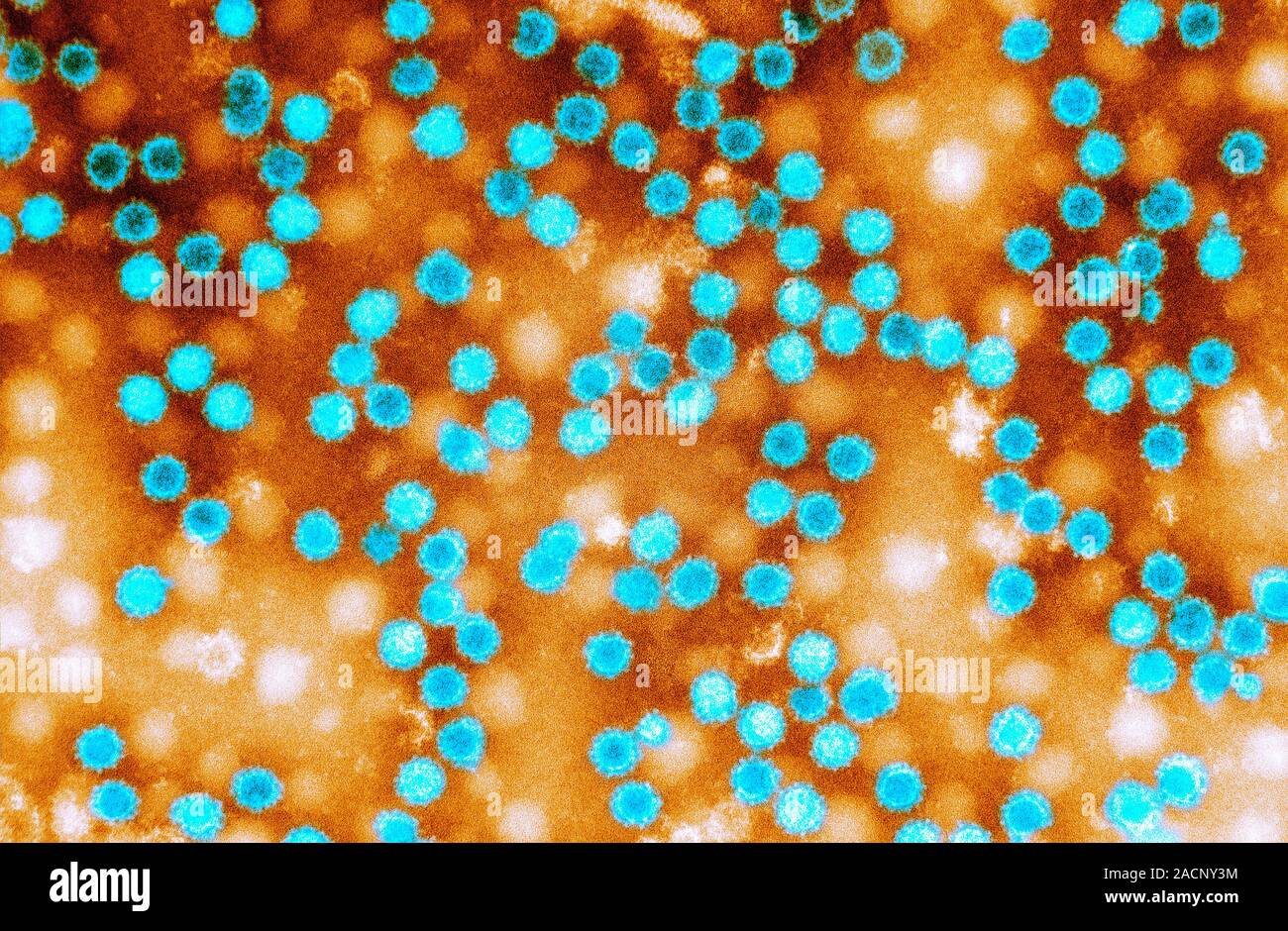 Norovirus particles. Coloured transmission electron micrograph (TEM) of ...