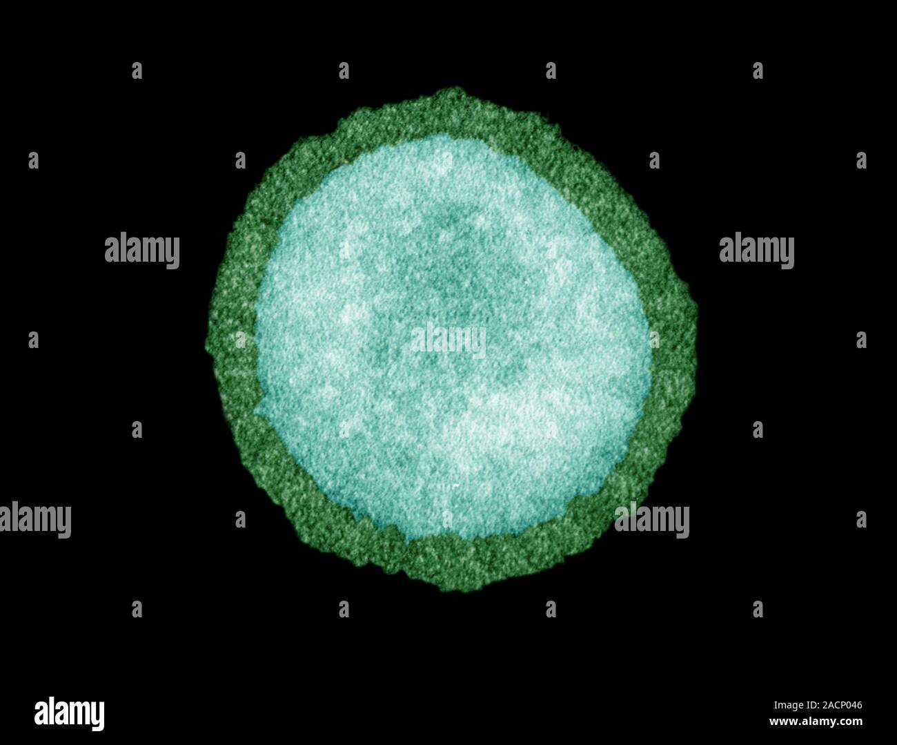 Influenza virus particle, coloured transmission electron micrograph ...