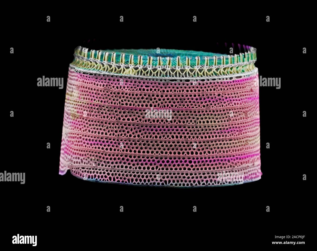 Diatom, coloured scanning electron micrograph (SEM). Diatoms are a ...