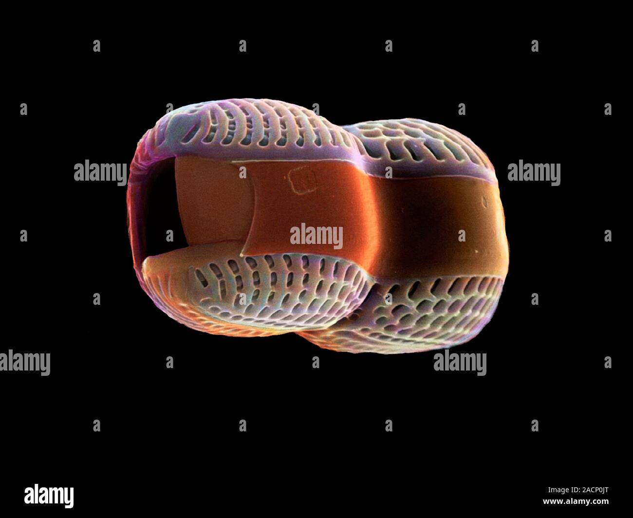 Diatom, coloured scanning electron micrograph (SEM). Diatoms are a ...