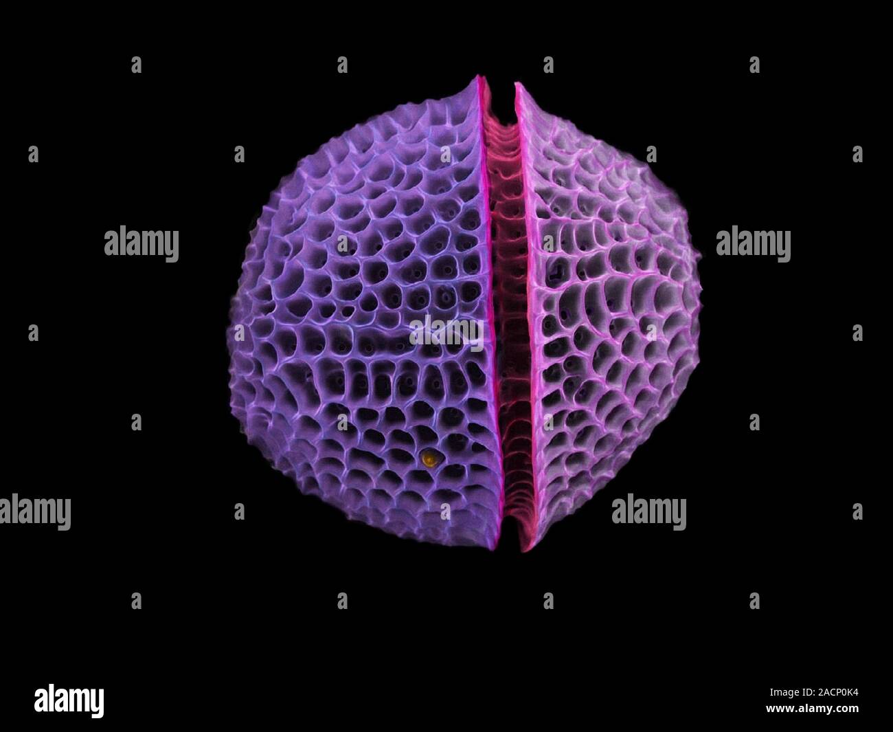 Diatom, coloured scanning electron micrograph (SEM). Diatoms are a ...