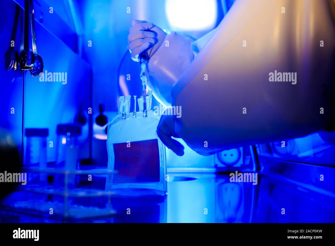 Blood plasma research. Scientist working with a blood plasma bag in a ...
