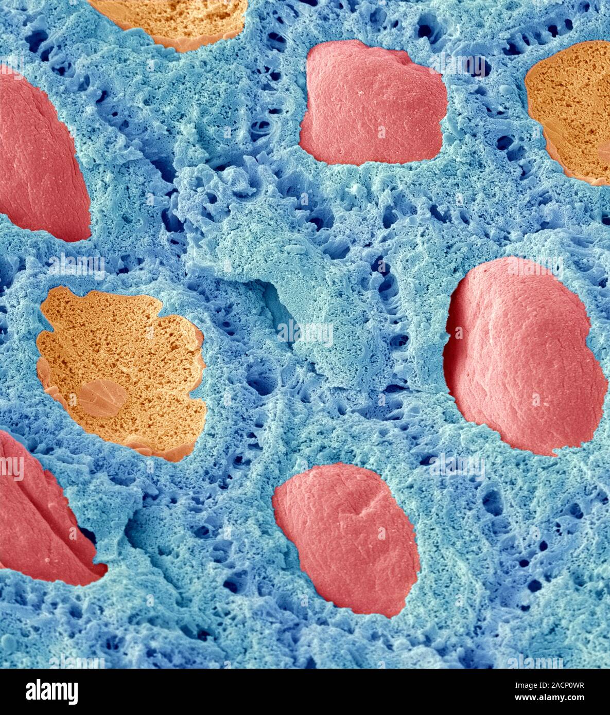 Keratinocyte skin cells. Coloured scanning electron micrograph (SEM) of ...