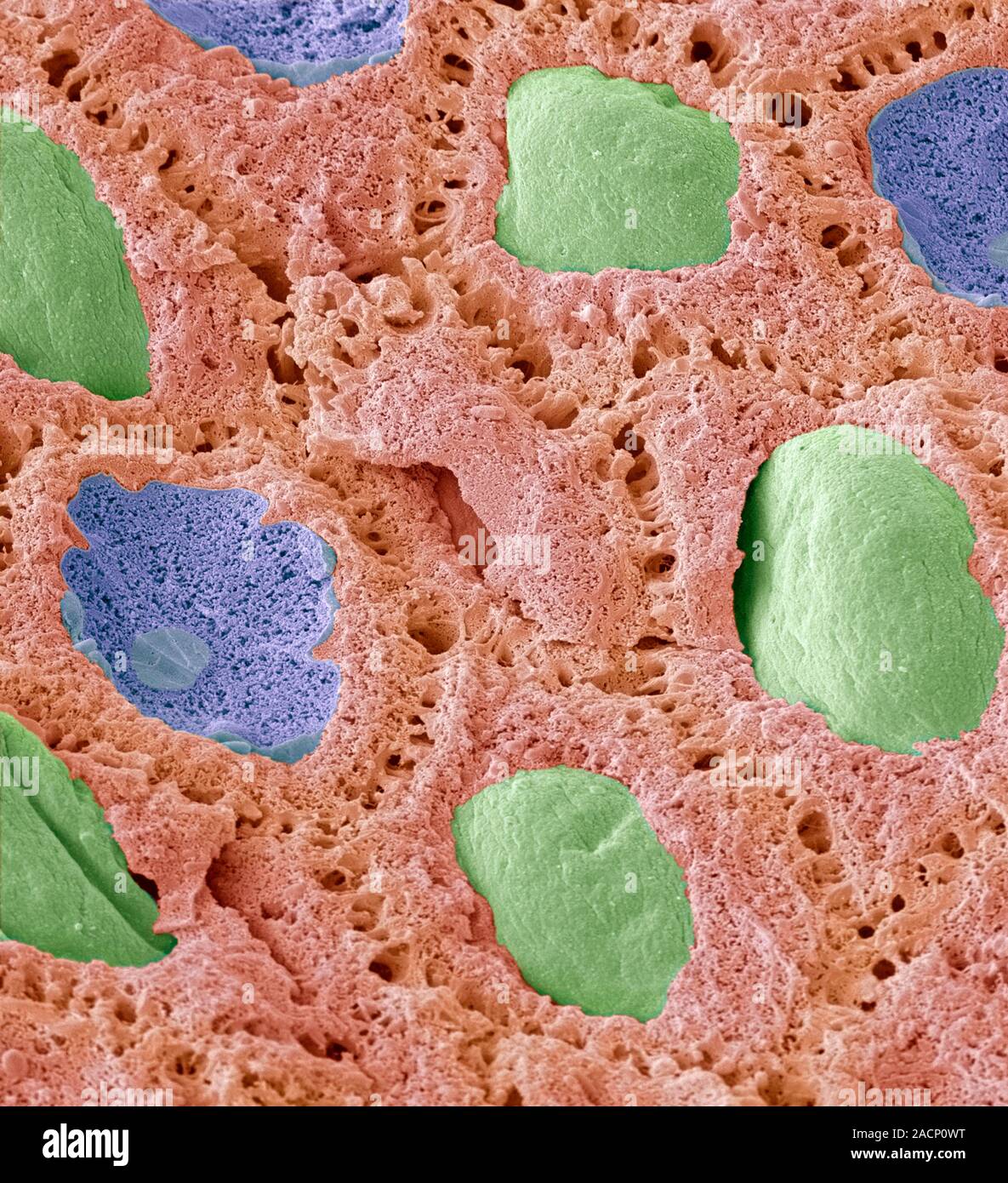 Keratinocyte skin cells. Coloured scanning electron micrograph (SEM) of ...