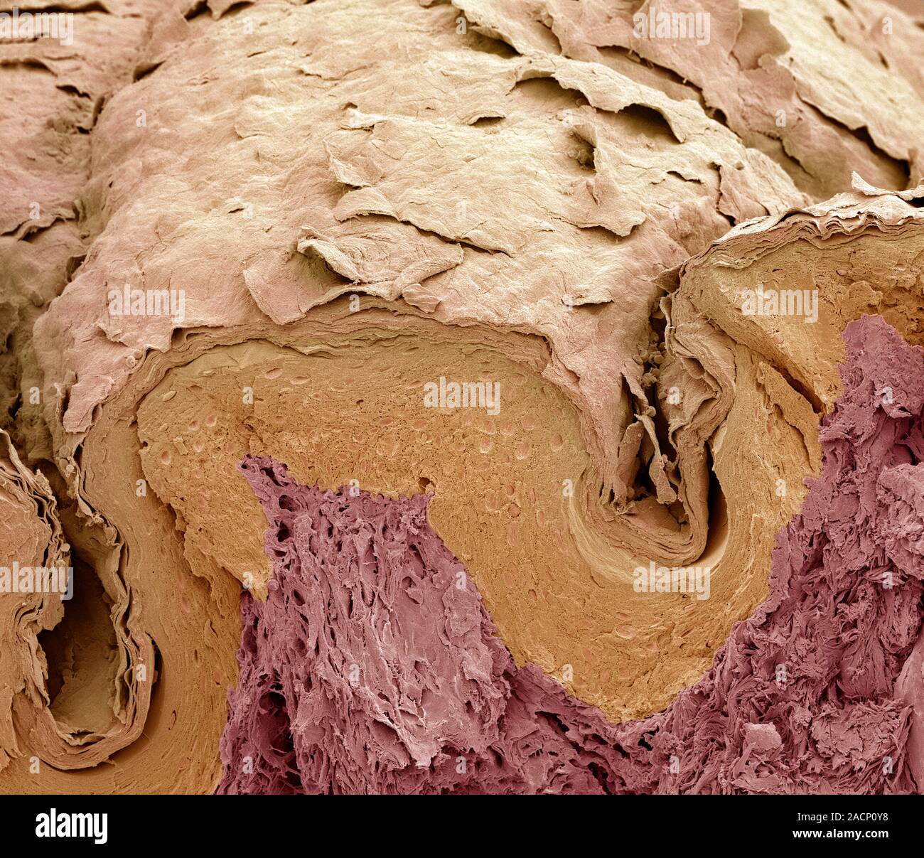 Finger skin. Coloured scanning electron micrograph (SEM) of a section ...