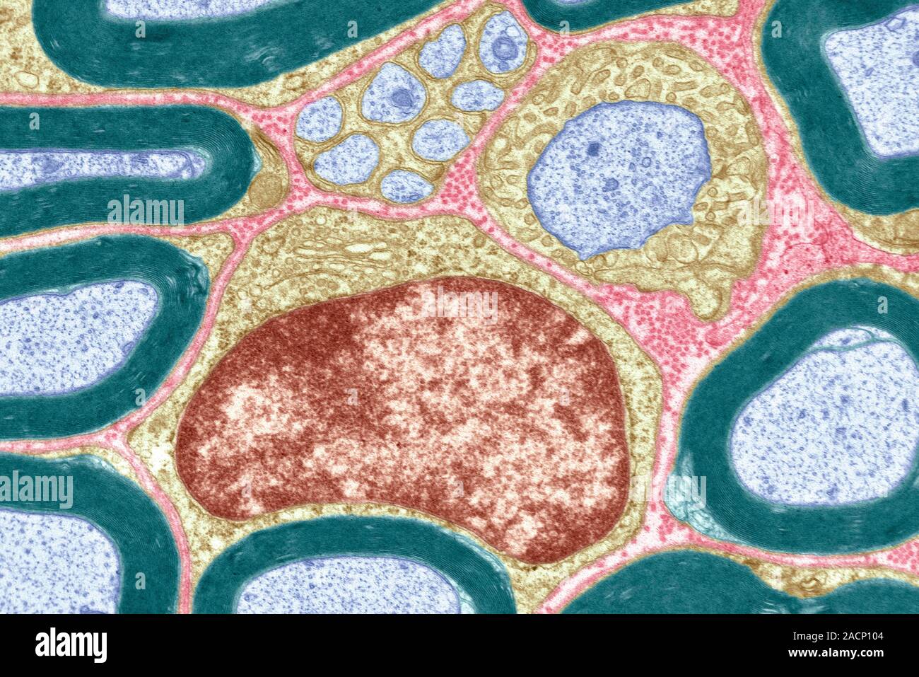 Nerve Fibre Transmission Electron Micrograph Tem Of A Section Through A Sciatic Nerve