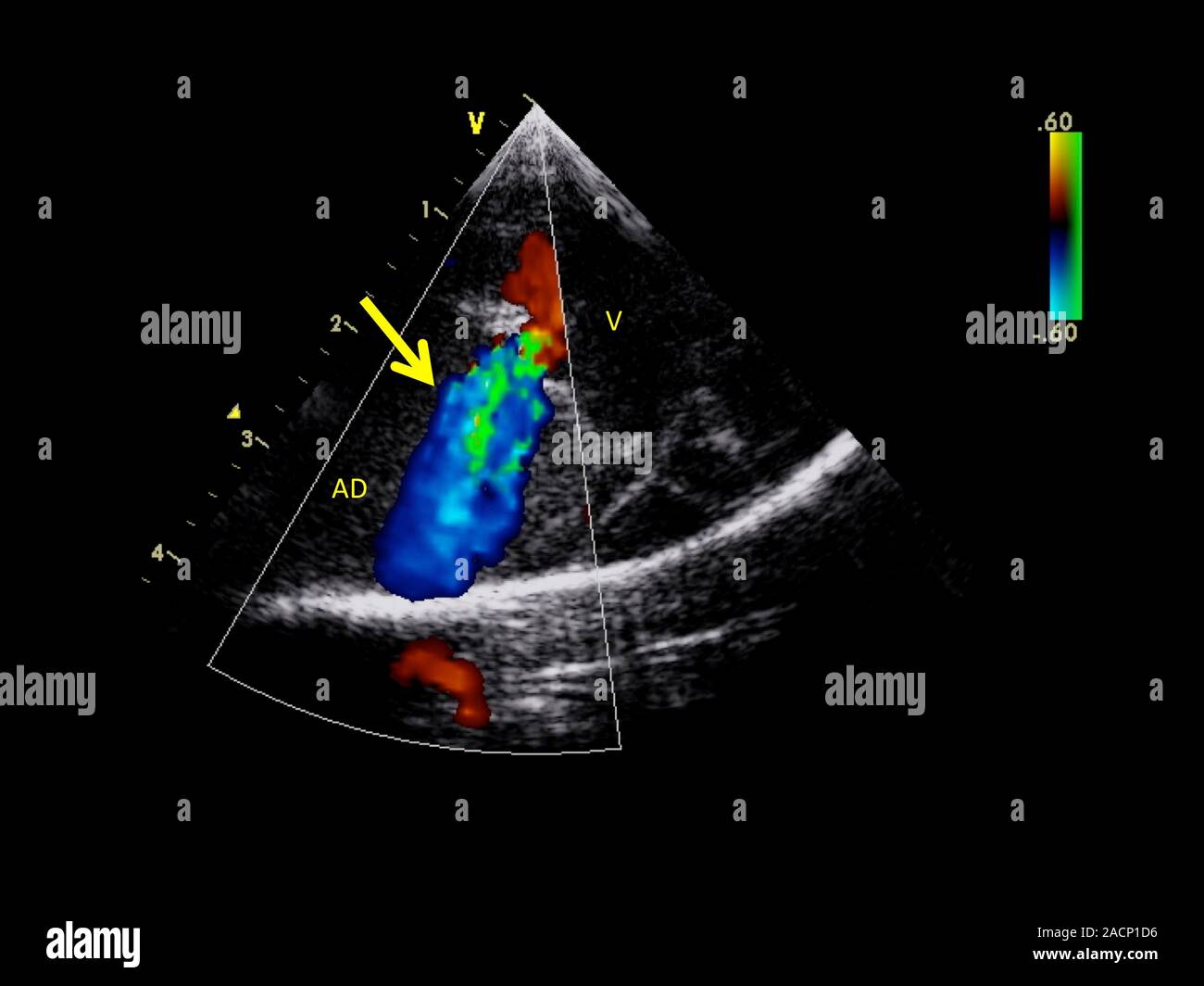 Python cardiology examination. Echocardiogram of the heart of a female ...