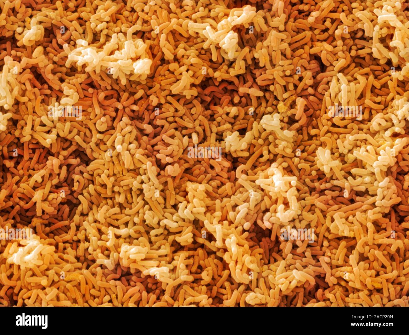 Lactobacillus casei bacteria. Scanning electron micrograph (SEM) of the ...