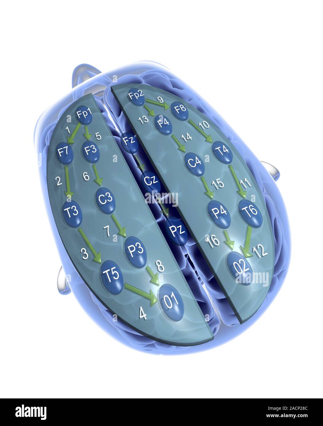 Electroencephalography Computer Artwork Depicting Of A Eeg Cap On Top