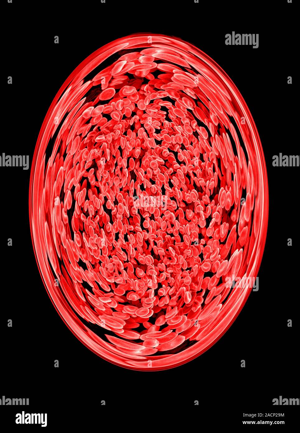 Red blood cells. Coloured scanning electron micrograph (SEM) of red ...