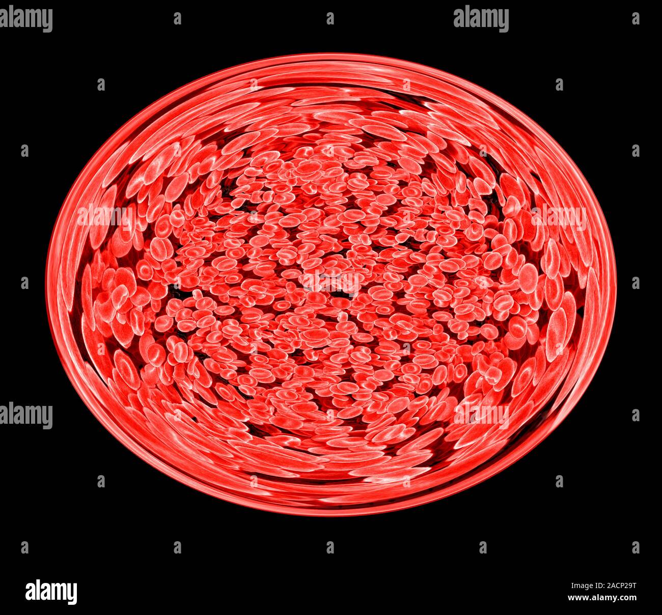 Red blood cells. Coloured scanning electron micrograph (SEM) of red ...