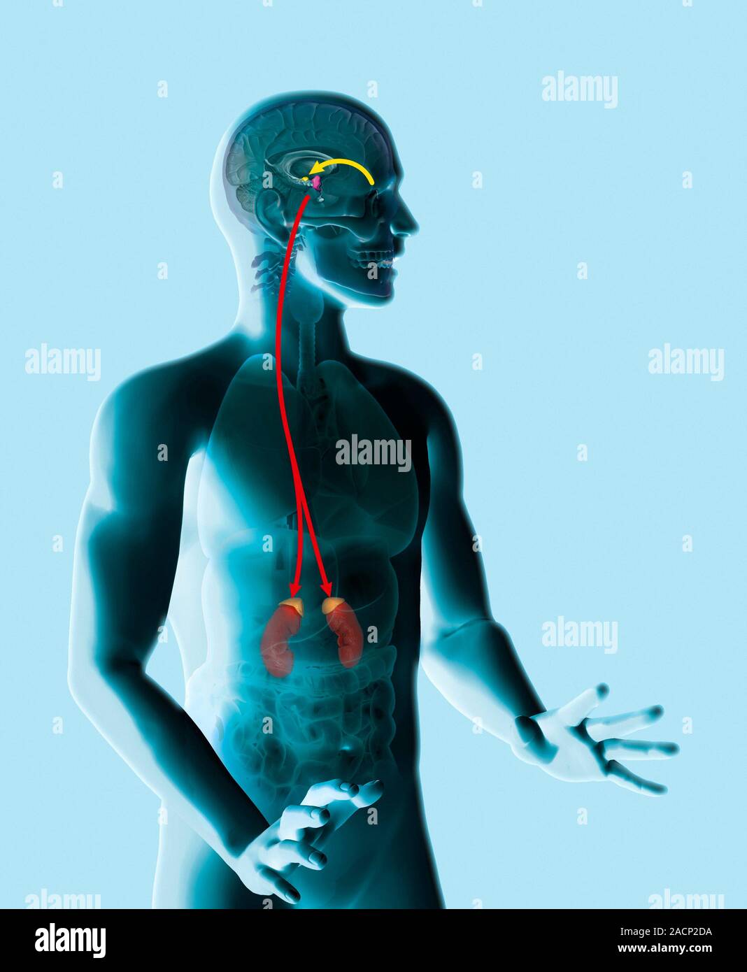 Fight-or-flight response. Artwork showing the body's 'fight-or-flight ...