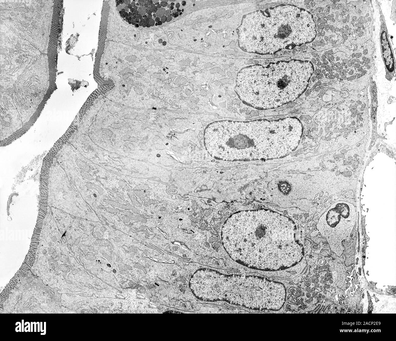 Small bowel epithelium. Transmission electron micrograph (TEM) of a ...
