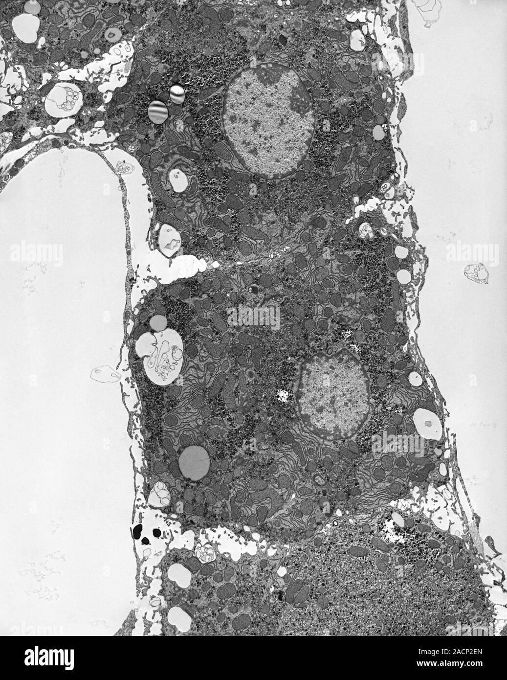 Liver tissue. Transmission electron micrograph (TEM) of a section ...