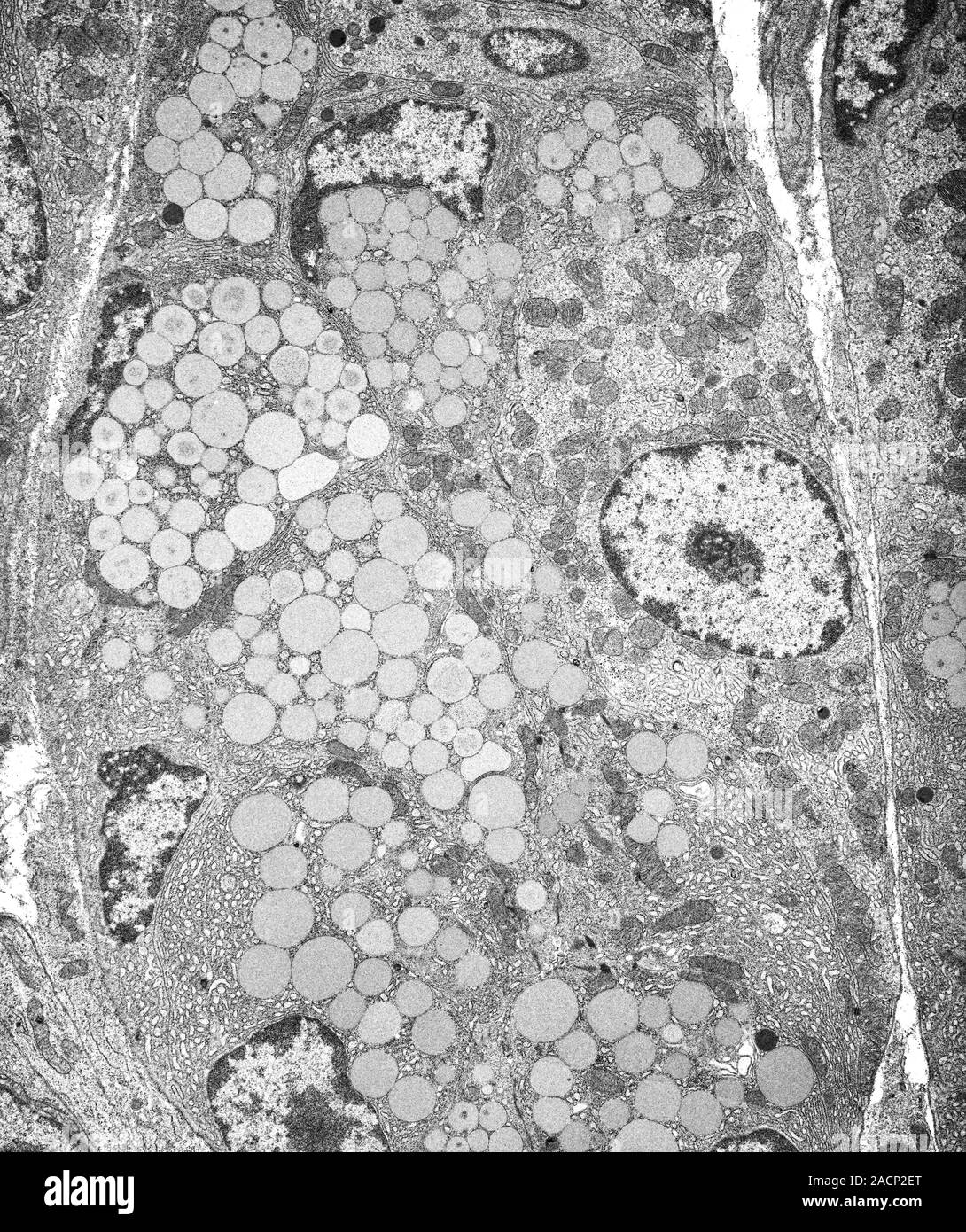 Gastric gland. Transmission electron micrograph (TEM) of a section ...