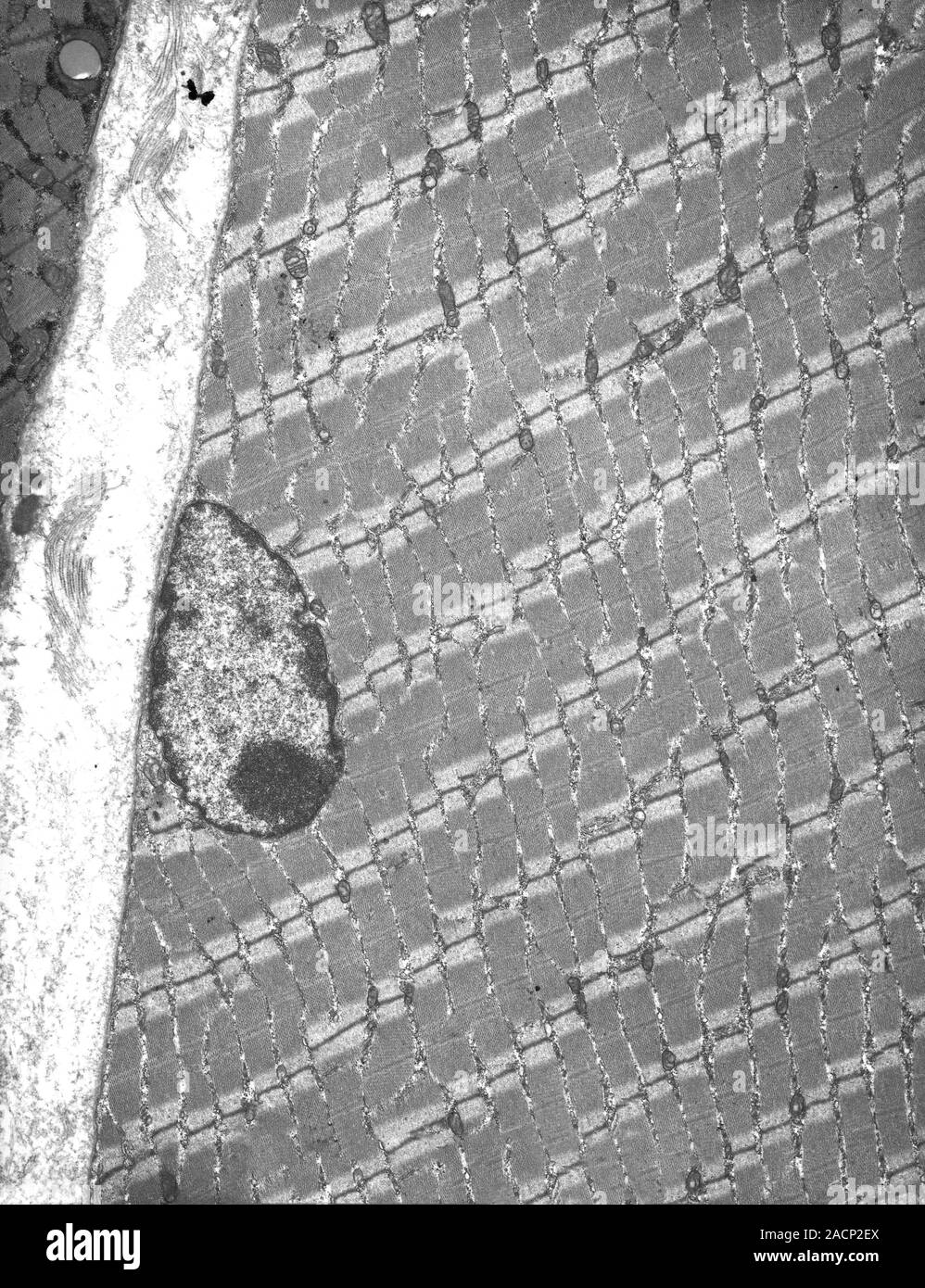 Skeletal muscle. Transmission electron micrograph (TEM) of a section through a skeletal muscle ...
