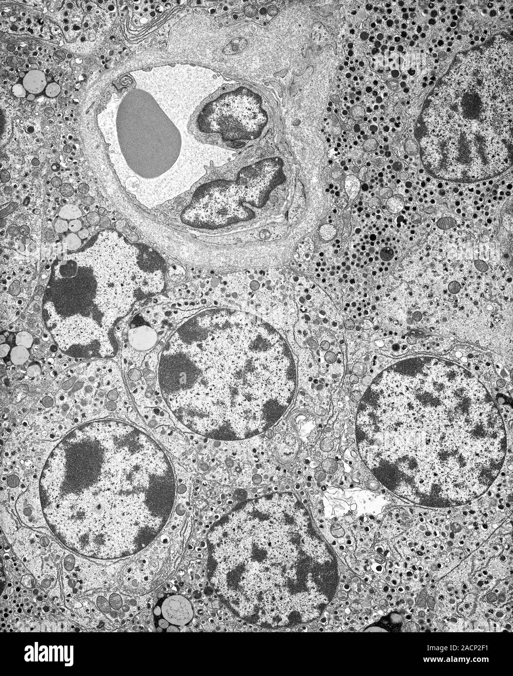 Islet of Langerhans. Transmission electron micrograph (TEM) of a ...