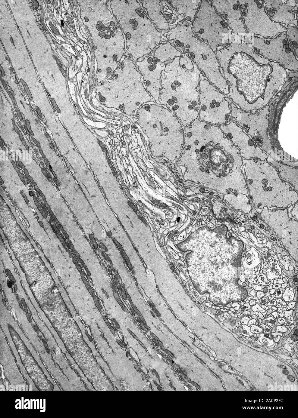 Smooth muscle of gut wall. Transmission electron micrograph (TEM) of a section through the ...