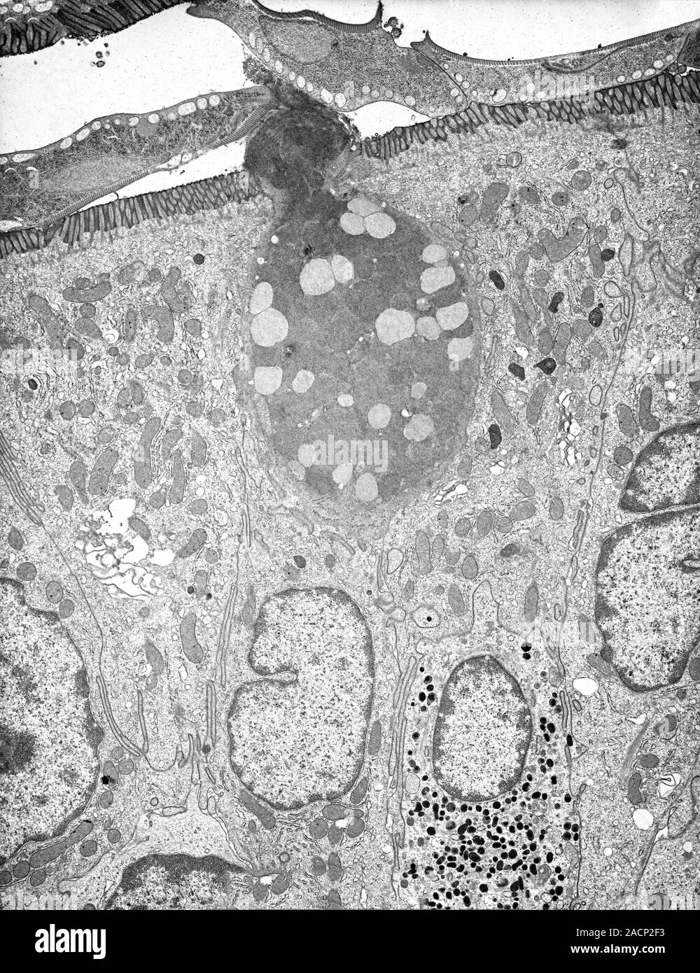Goblet cell. Transmission electron micrograph (TEM) of a section ...