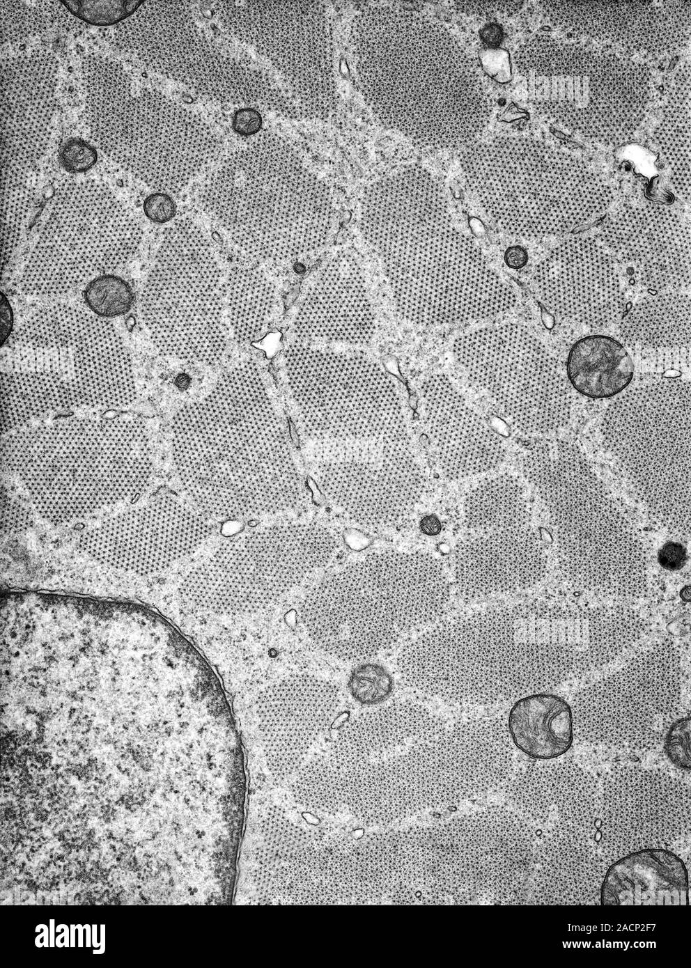 Skeletal muscle. Transmission electron micrograph (TEM) of a section through a skeletal muscle ...